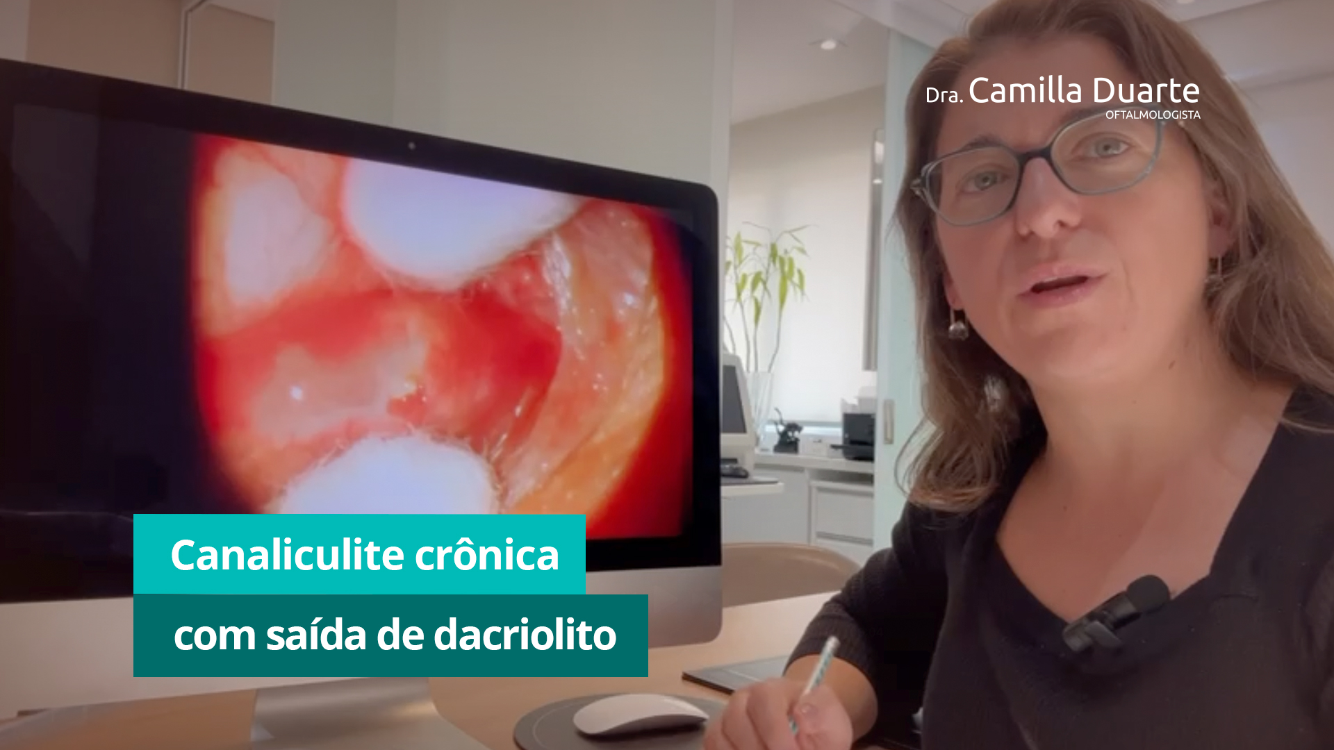 Canaliculite crônica: quando uma “bolinha” na pálpebra pode esconder um ...